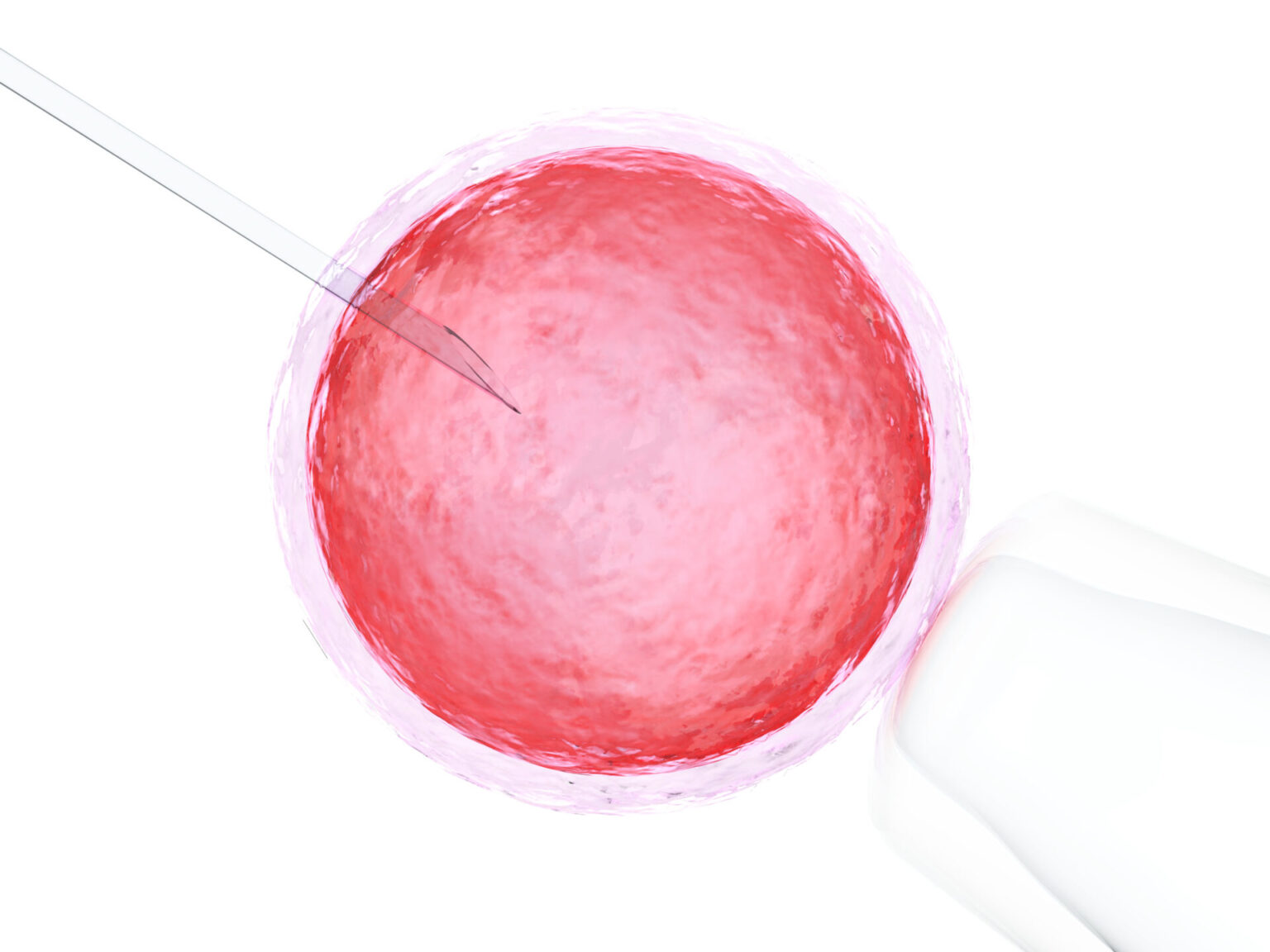 Inseminación intrauterina: Conceptos básicos • Clinica Imar
